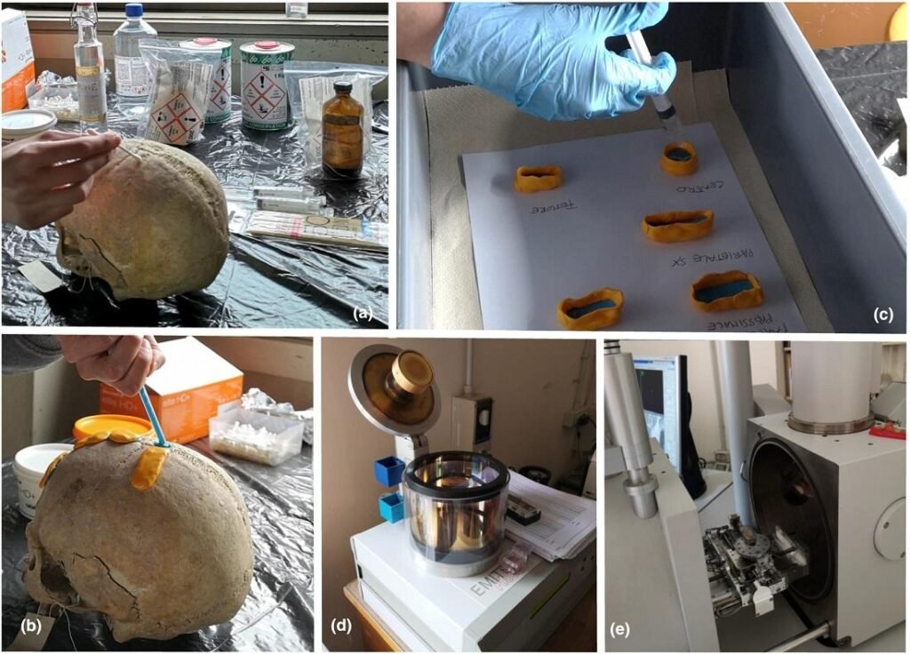 Archaeologists found evidence of surgery on medieval woman’s skull ...