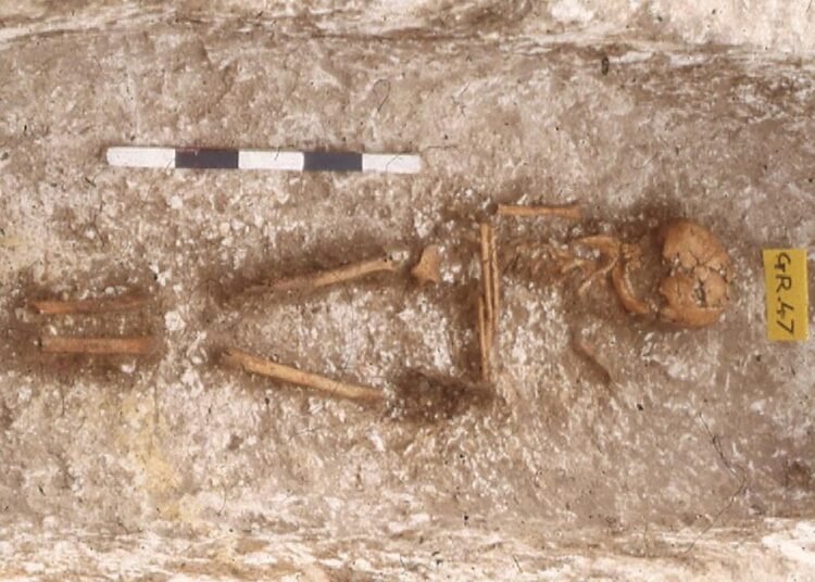 Archaeologists found evidence of surgery on medieval woman’s skull ...