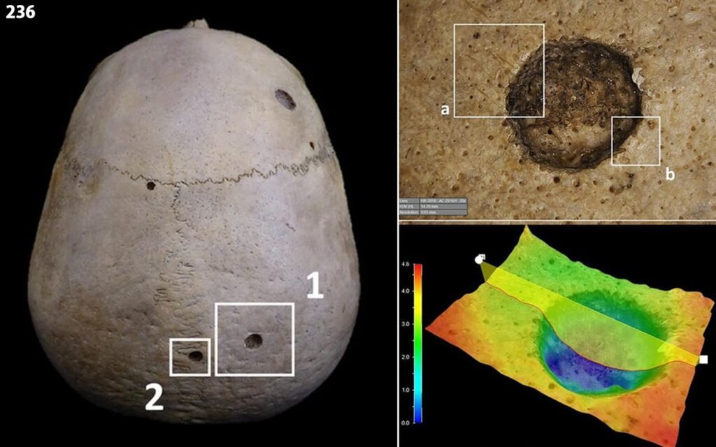 Ancient Egyptian doctors tried to treat cancer 4,000 years ago ...