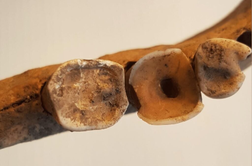 Uncovering advanced dentistry practices among Vikings | Archaeology ...