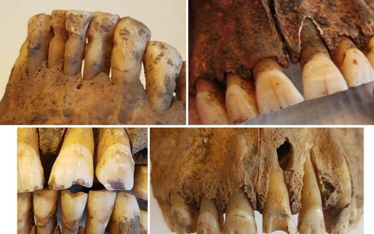 Uncovering advanced dentistry practices among Vikings | Archaeology ...